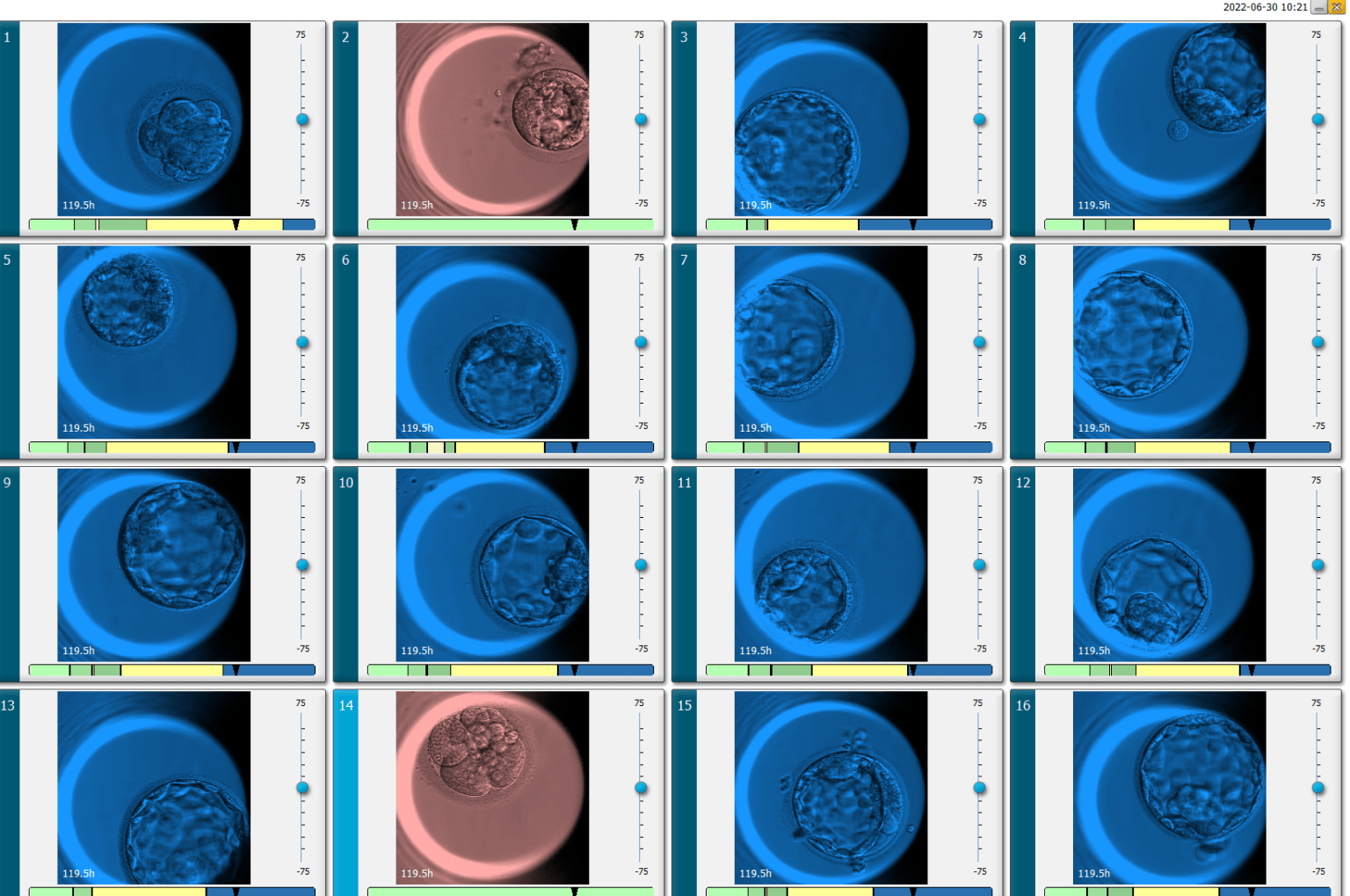 Alpha IVF Uses AI in Fertility Treatment - BusinessToday