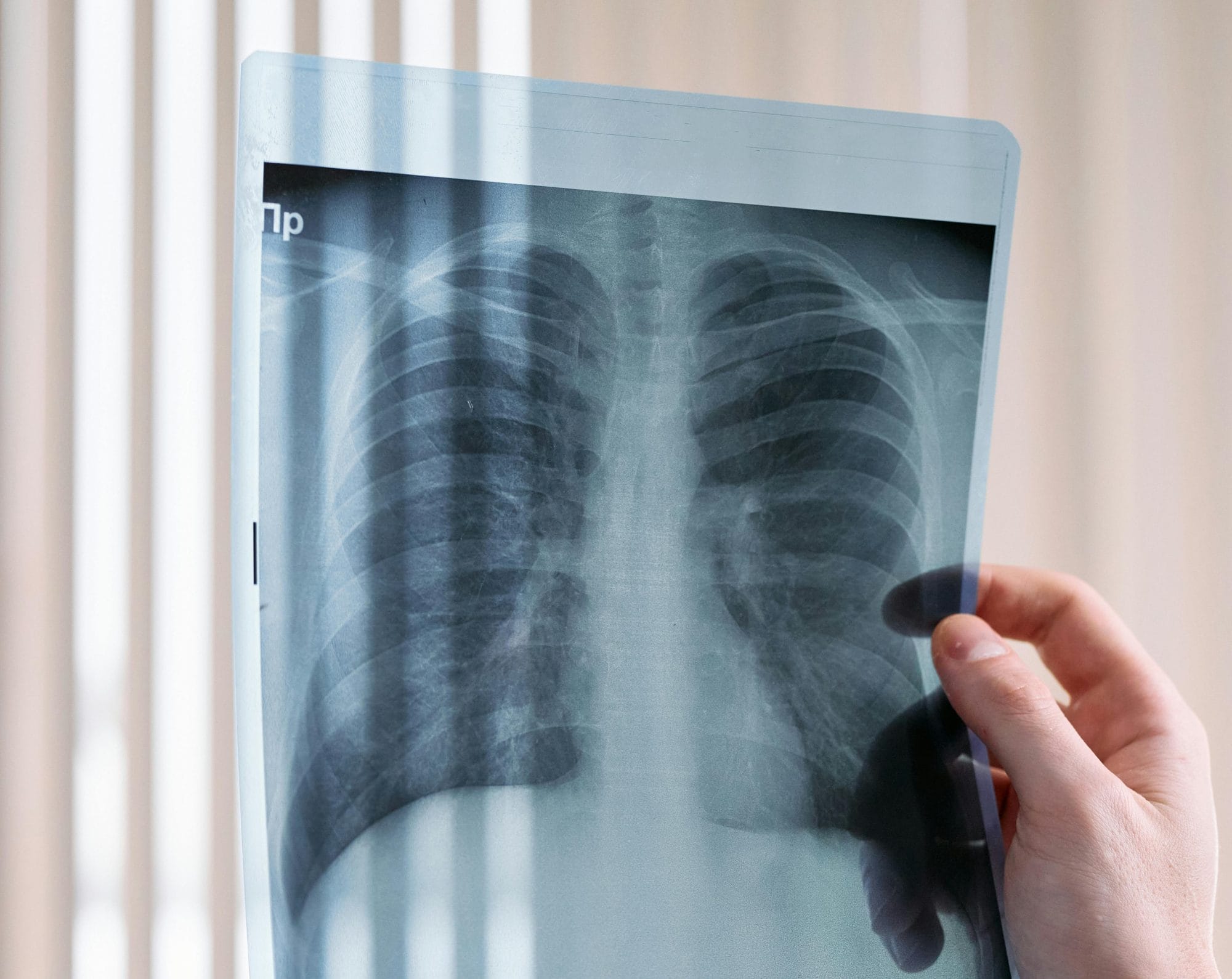 Supporting Lungs, Saving Lives - BusinessToday